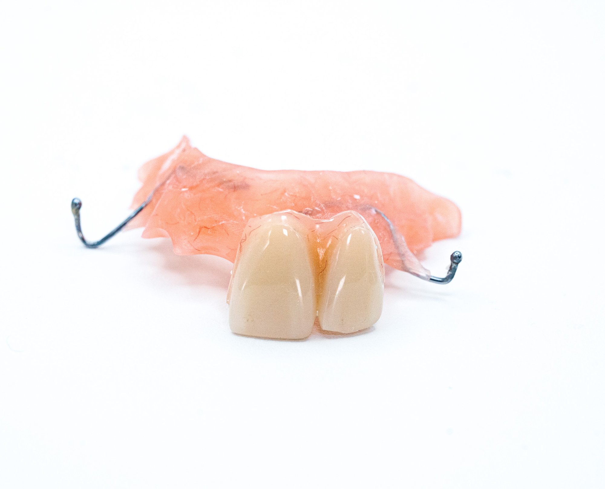 All-Acrylic Partial (Flipper)